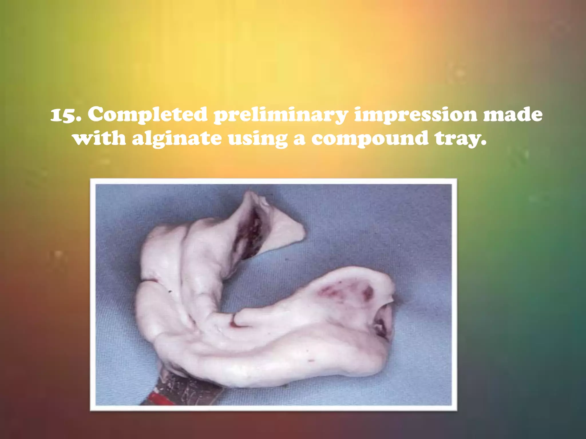 Impressions in complete dentures | PPTX