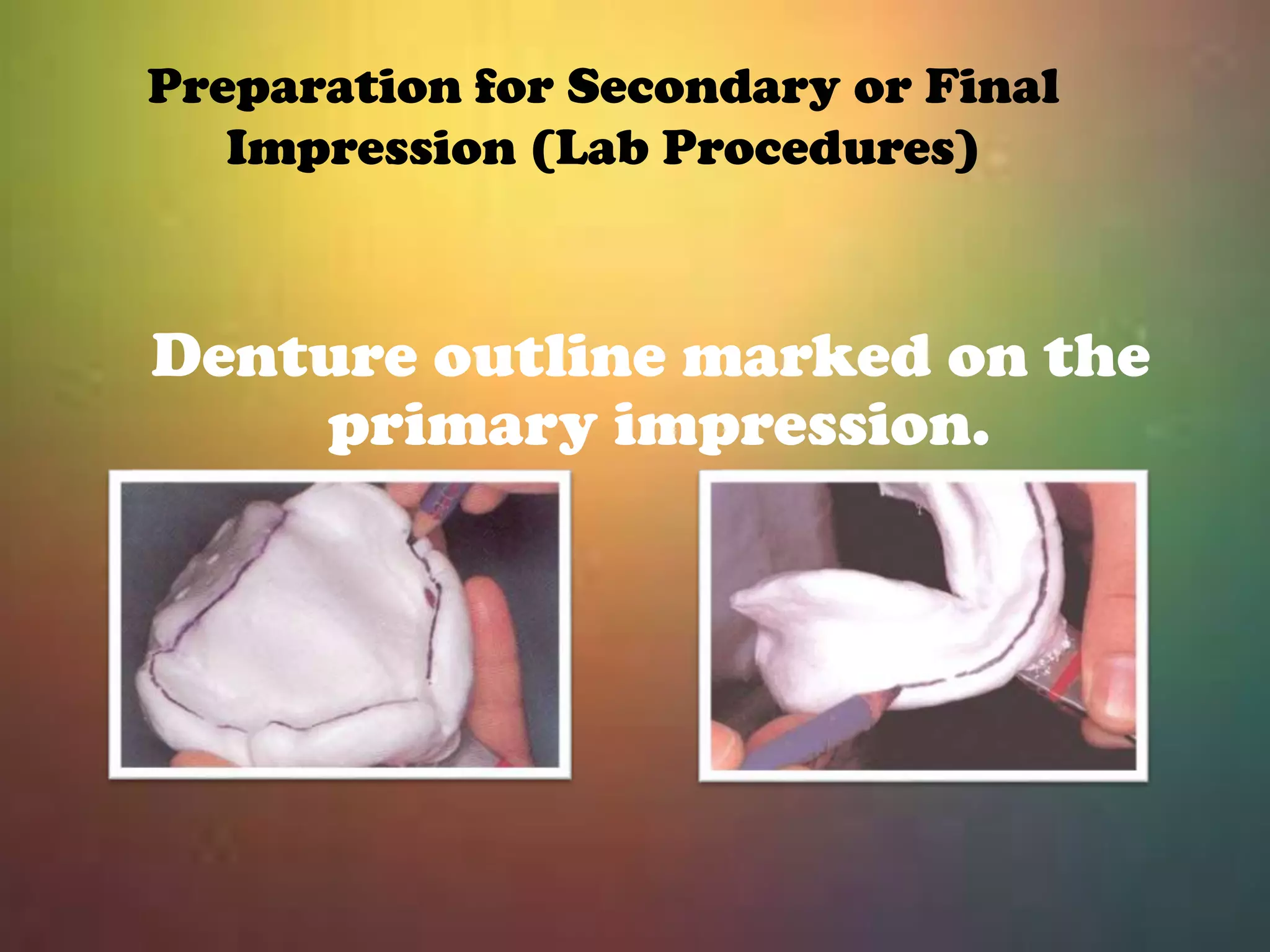 Impressions in complete dentures | PPTX