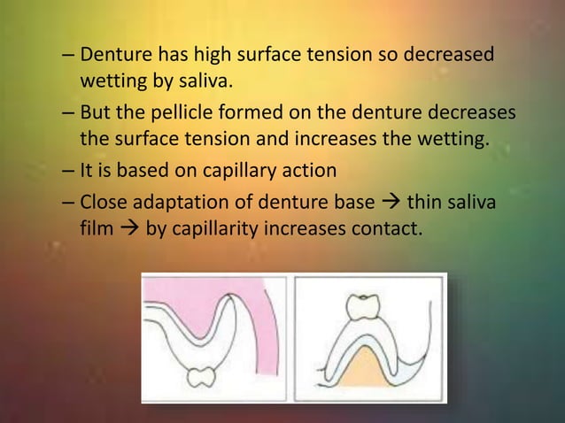 Impressions in complete dentures | PPTX | Dental Health | Diseases and Conditions