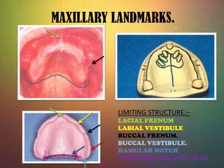 Impressions in complete dentures | PPTX