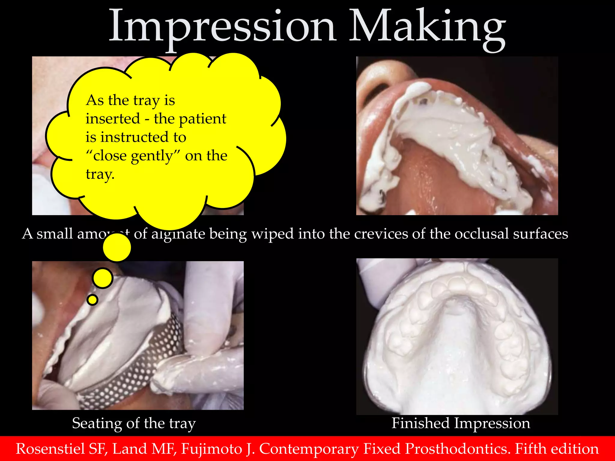 Impressions in fixed partial denture | PPTX