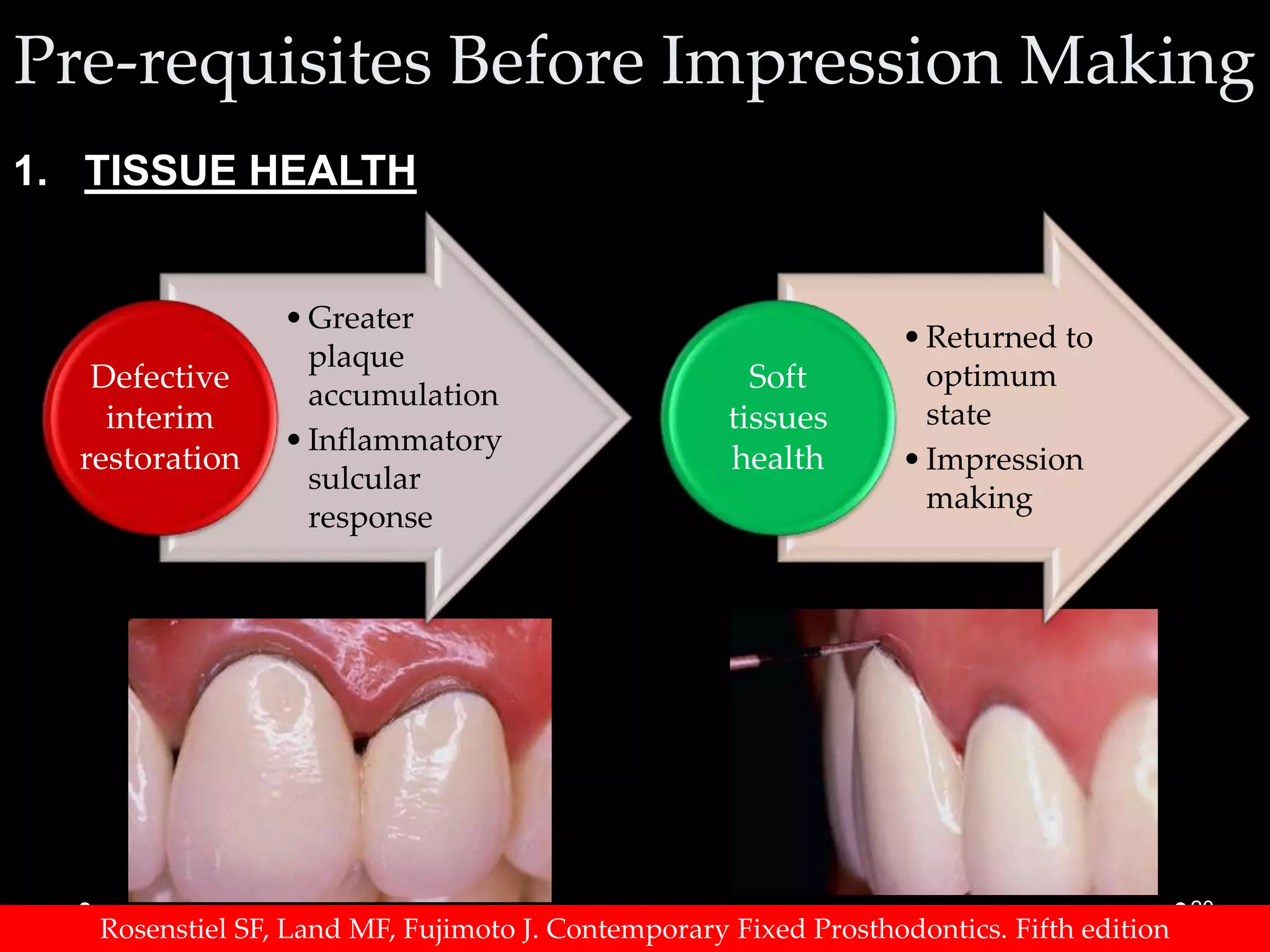 Impressions in fixed partial denture | PPTX