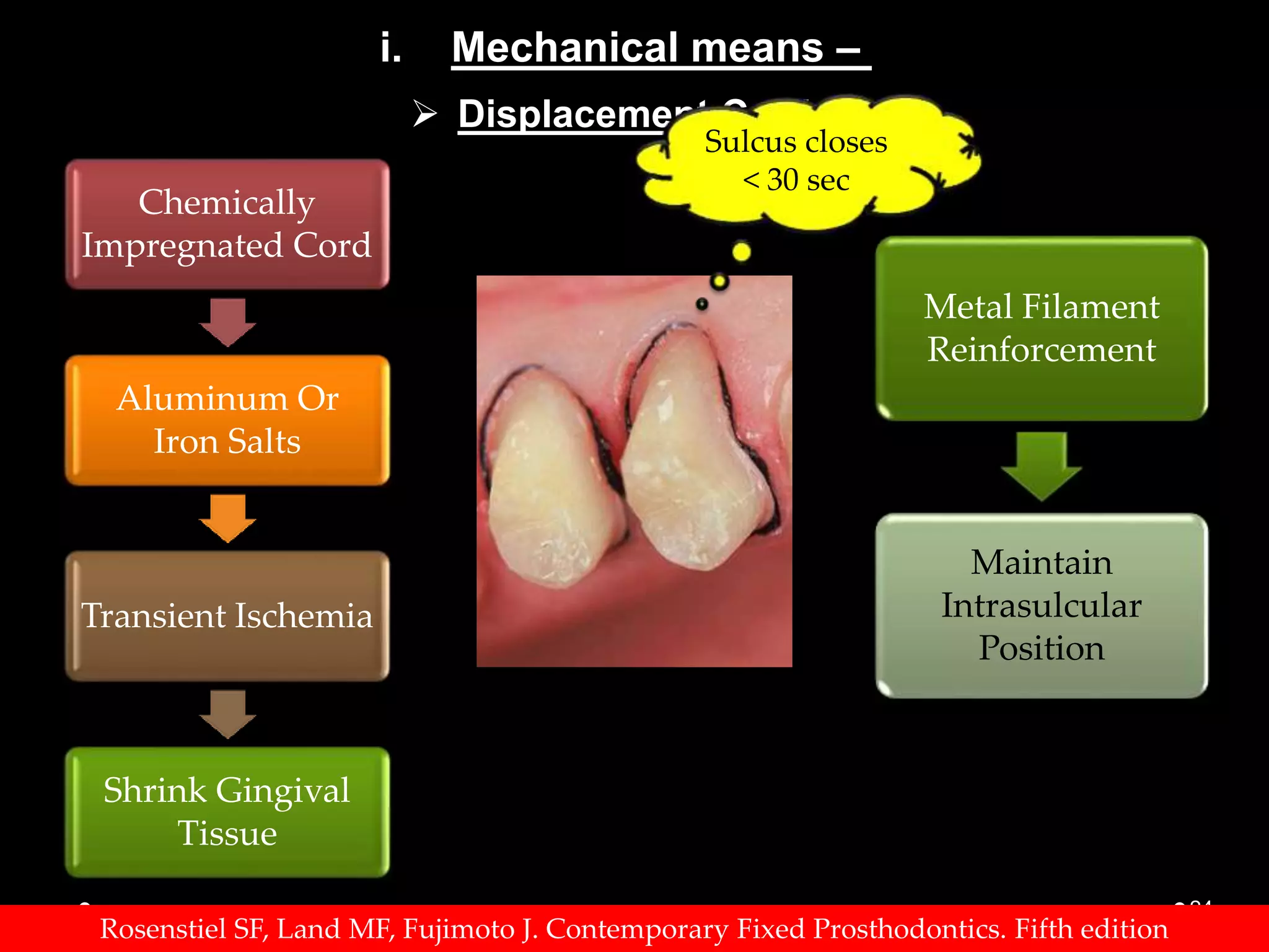 Impressions in fixed partial denture | PPTX