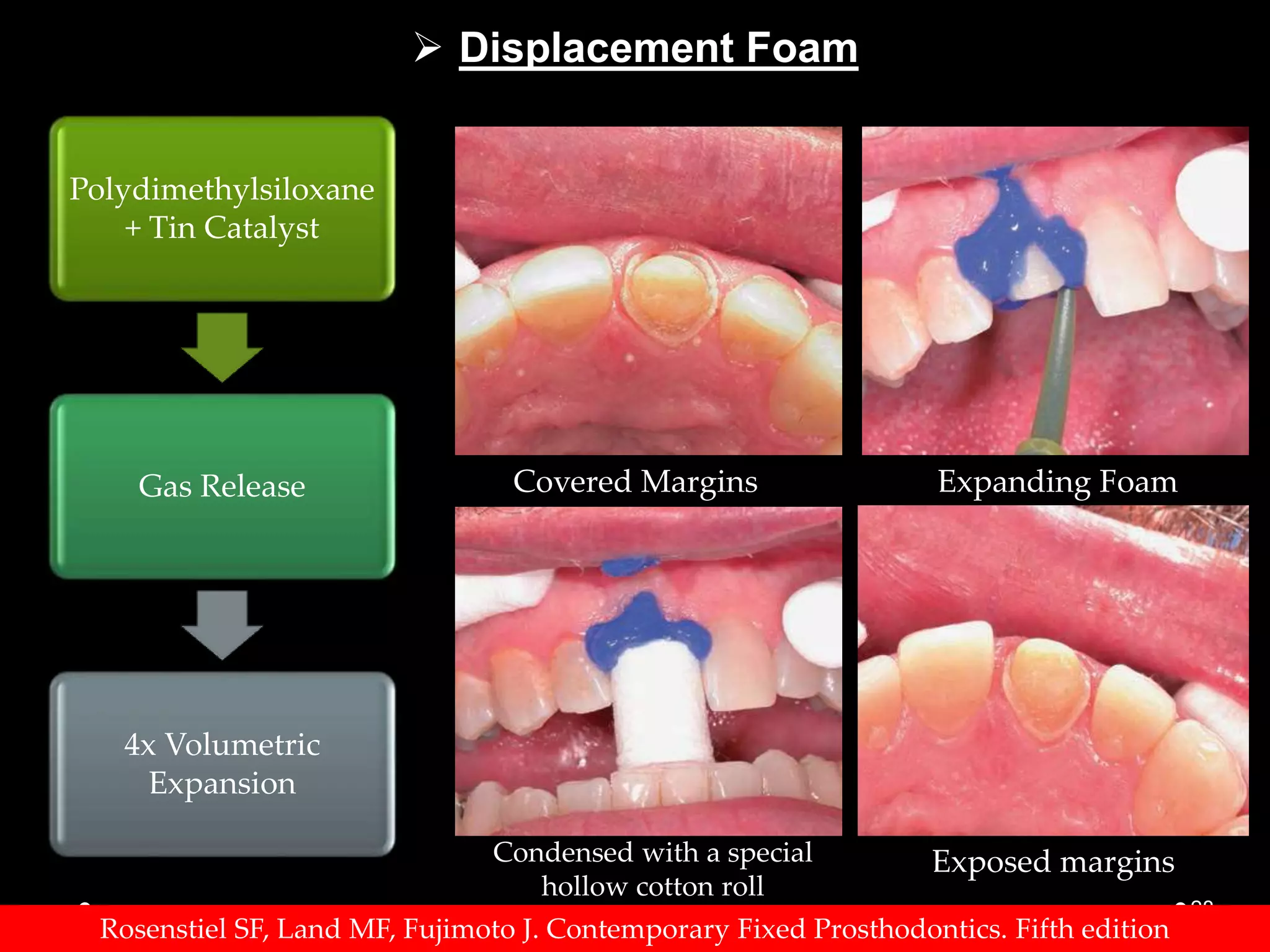 Impressions in fixed partial denture | PPTX