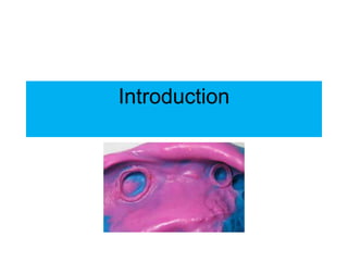 Impressions in fpd | PPT