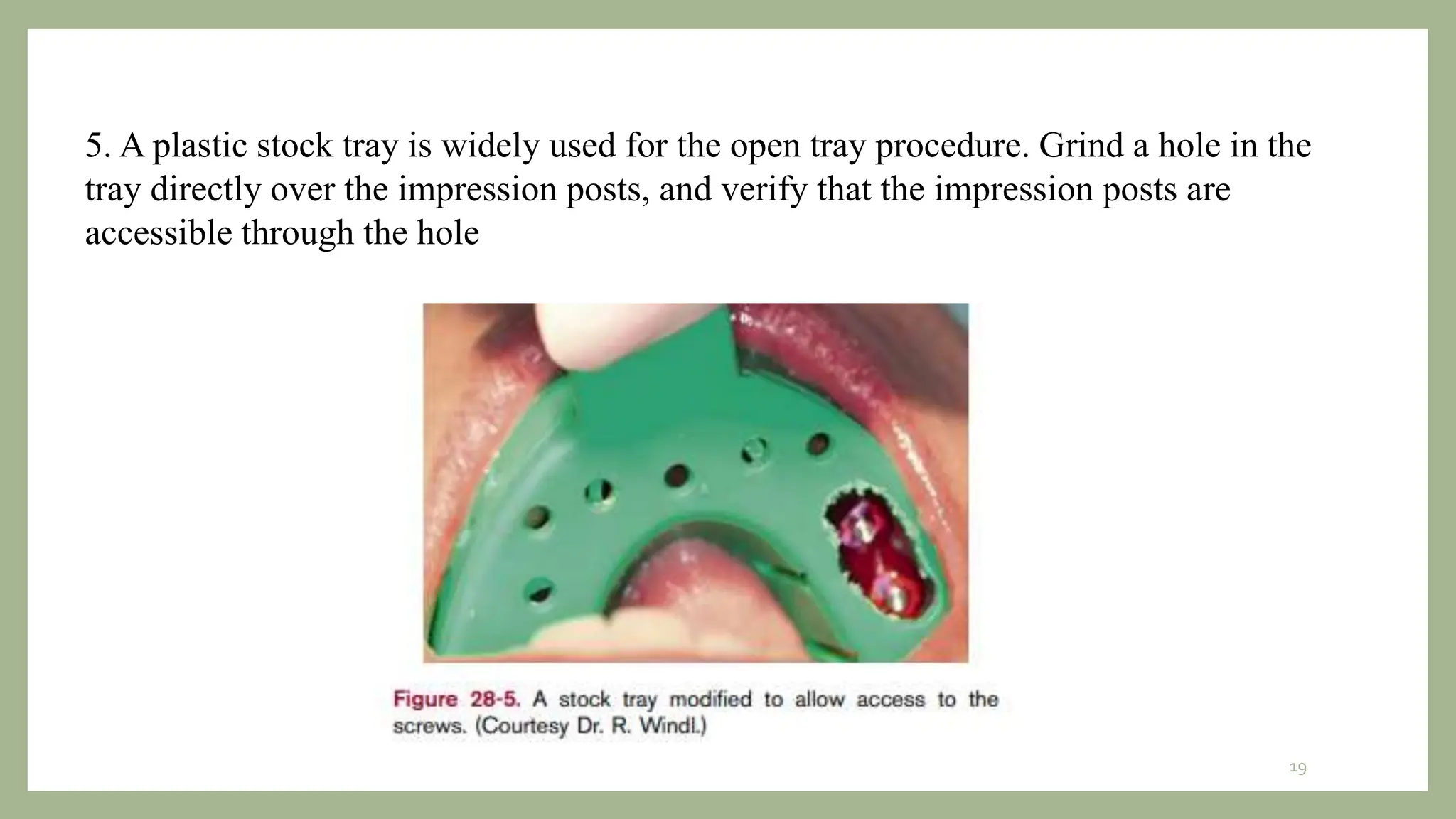 impressions in implants.pptx