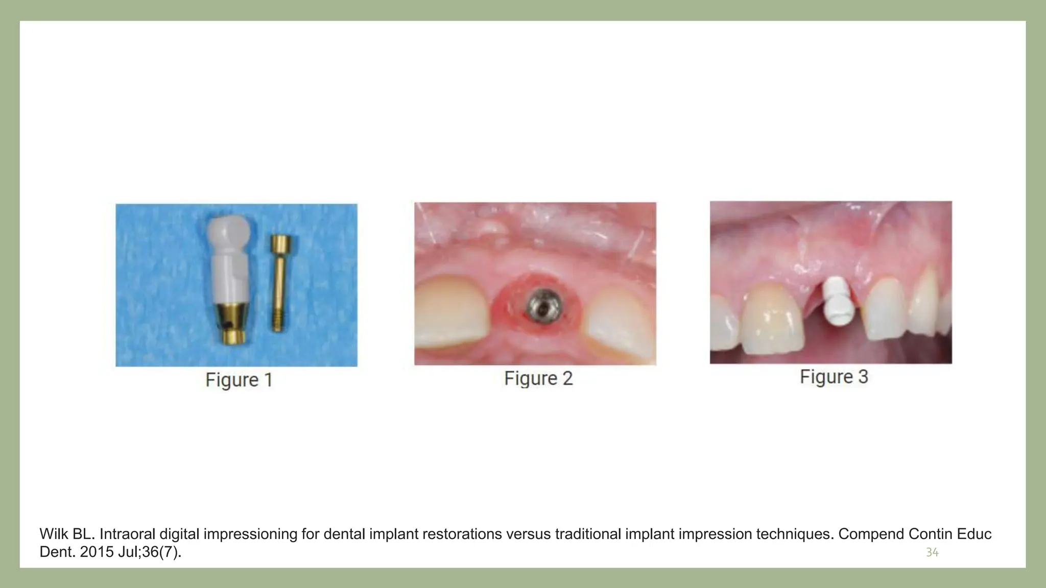 impressions in implants.pptx