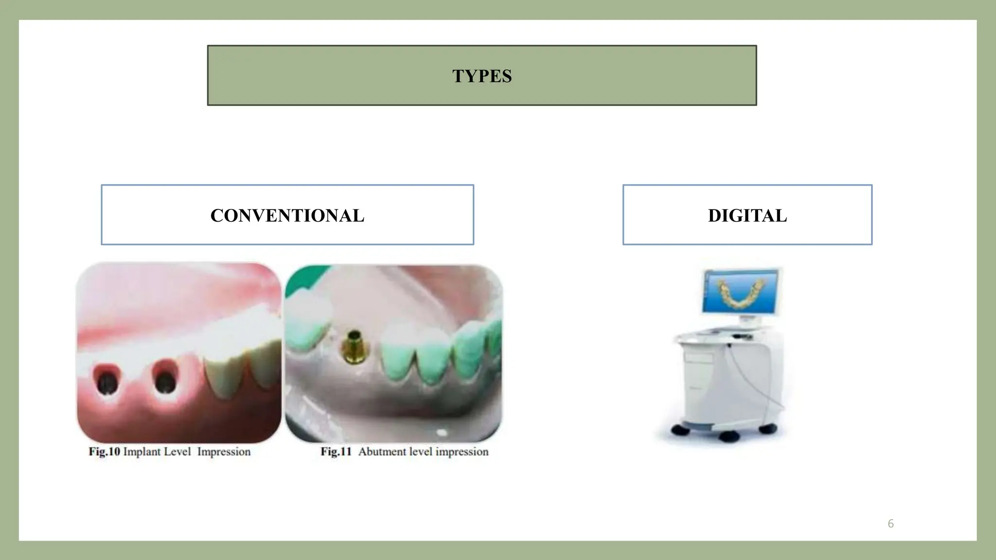 impressions in implants.pptx