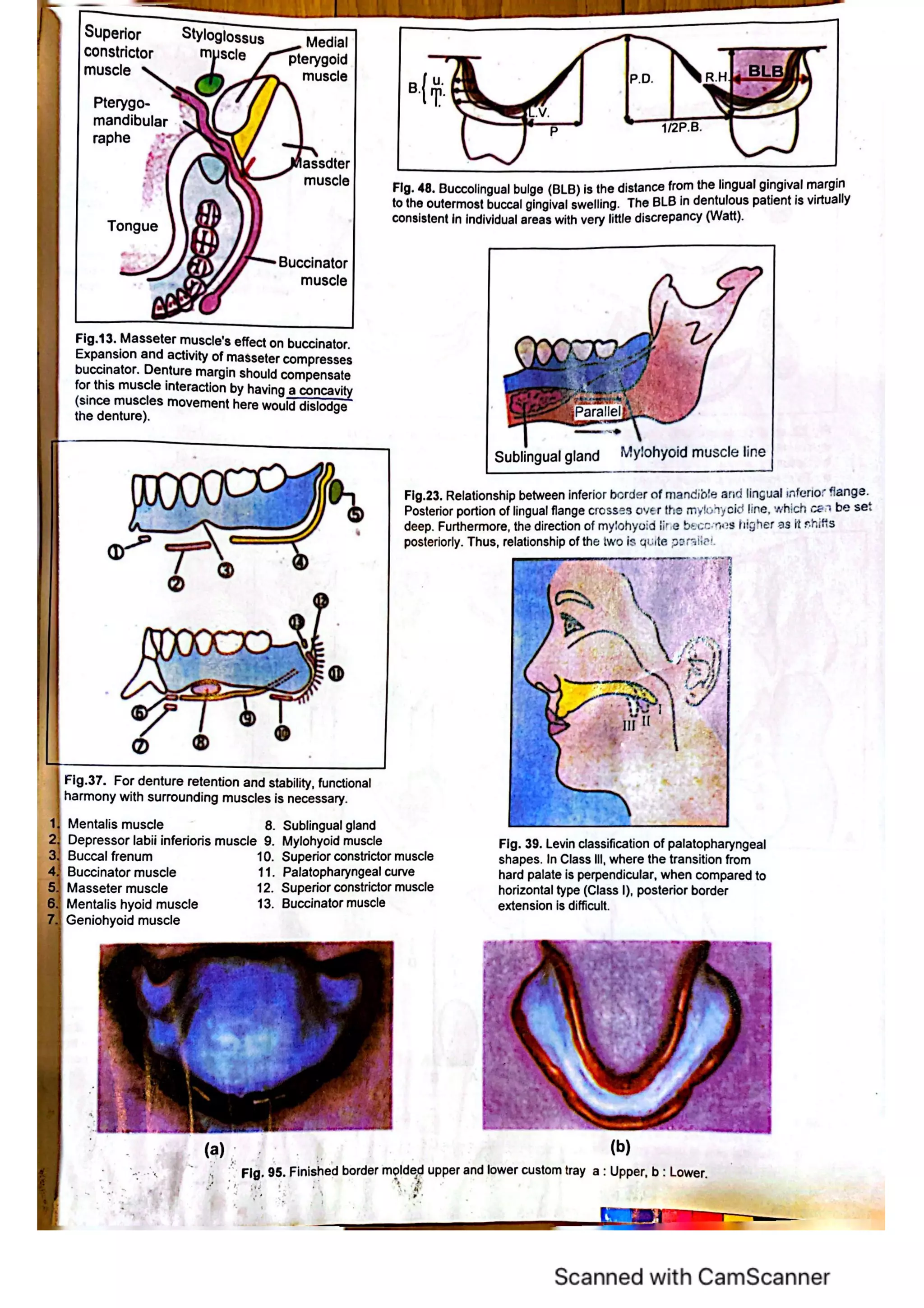 Impressions of Edentulous Patients (Dental Technique Series 4).pdf
