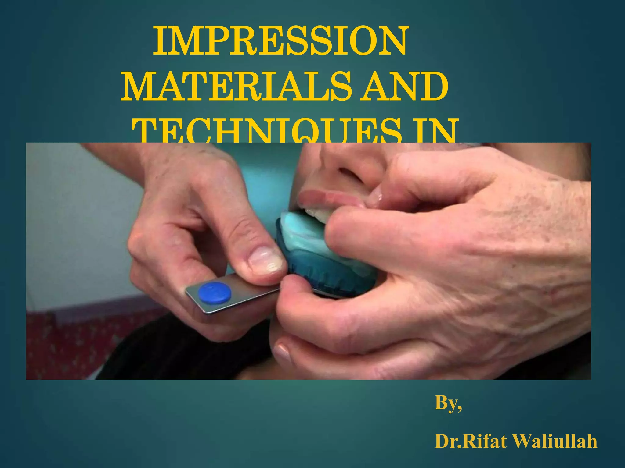 Impression Taking By Alginate | PPTX