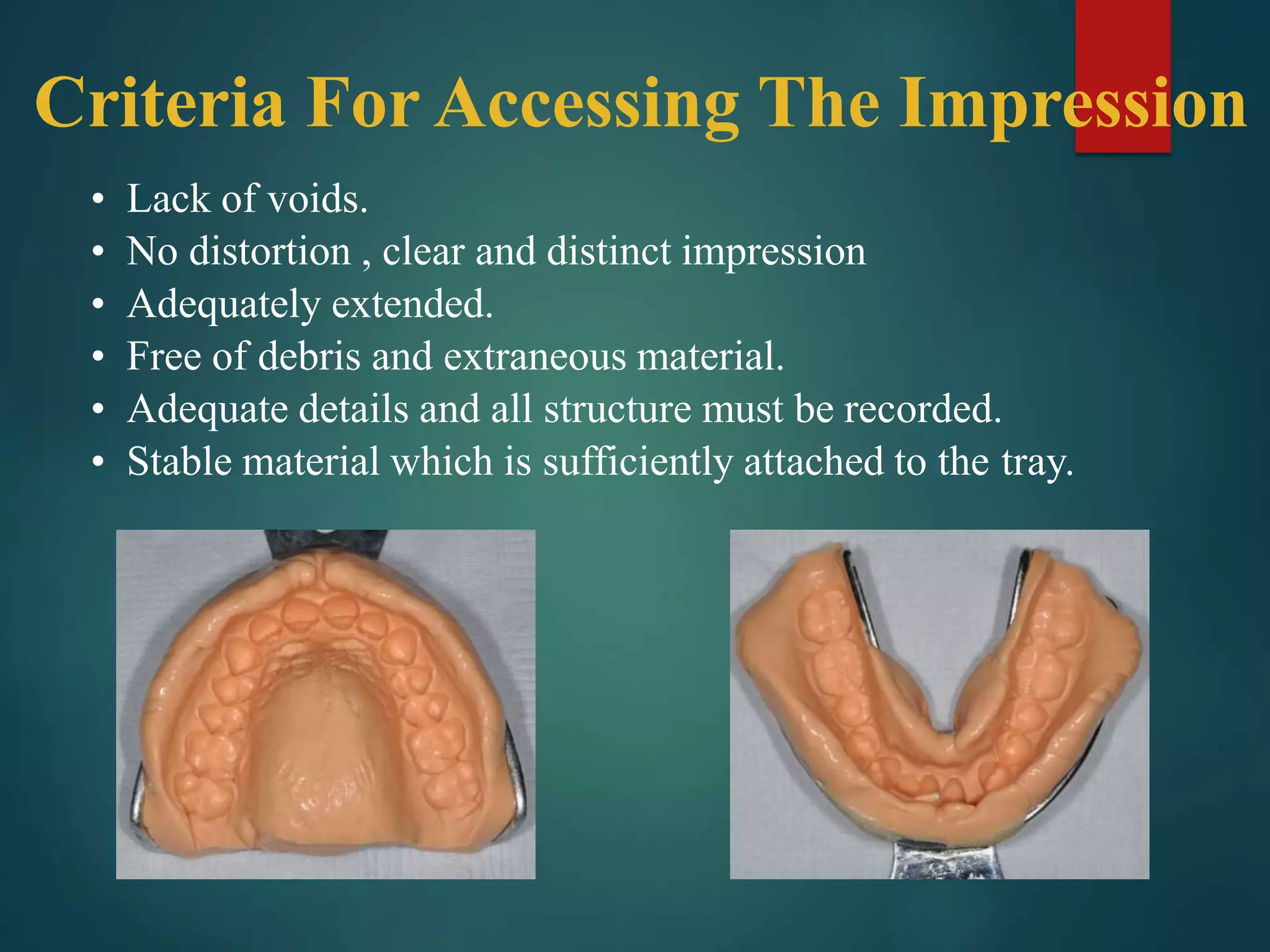 Impression Taking By Alginate | PPTX