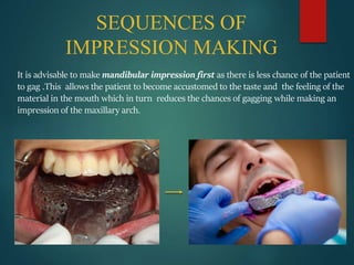 Impression Taking By Alginate | PPTX