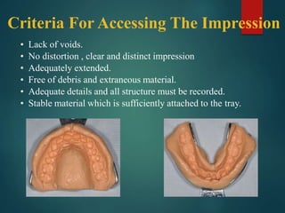 Impression Taking By Alginate | PPTX