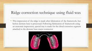 IMPRESSION TECHNIQUE IN RPD in prosthodontics | PPTX