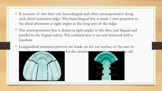 IMPRESSION TECHNIQUE IN RPD in prosthodontics | PPTX