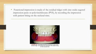 IMPRESSION TECHNIQUE IN RPD in prosthodontics | PPT