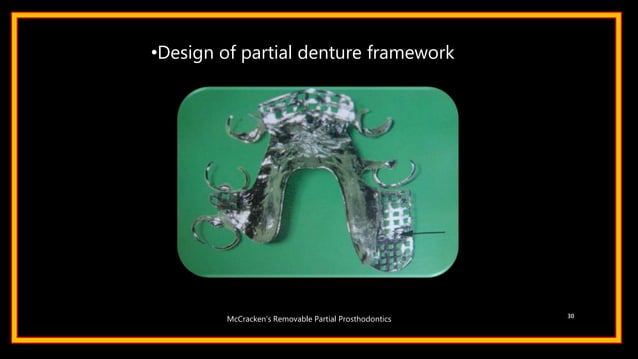 Impression techniques in rpd | PPTX