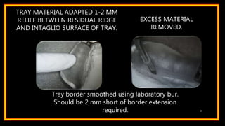 Impression techniques in rpd | PPTX