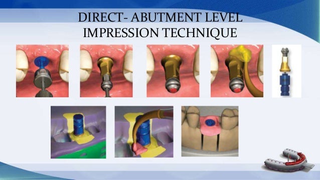 Impression techniques