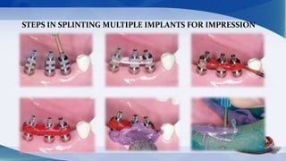 Impression techniques | PPTX