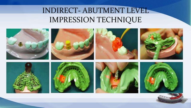 Impression techniques | PPTX