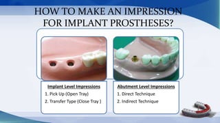 Impression techniques | PPTX