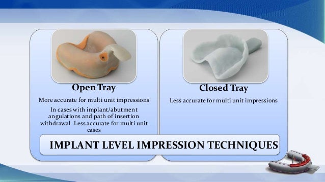 Impression techniques