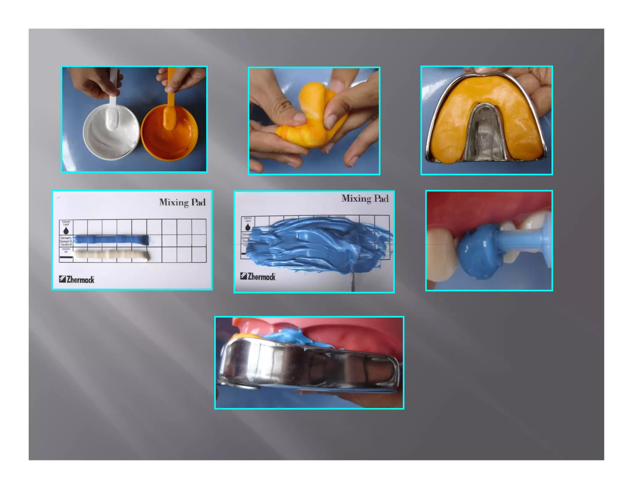 Impression techniques | PDF