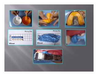 Impression techniques | PDF