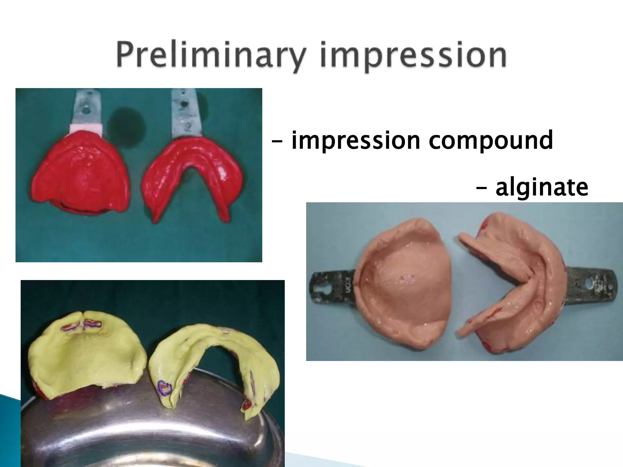 Impression techniques in complete denture | PPTX