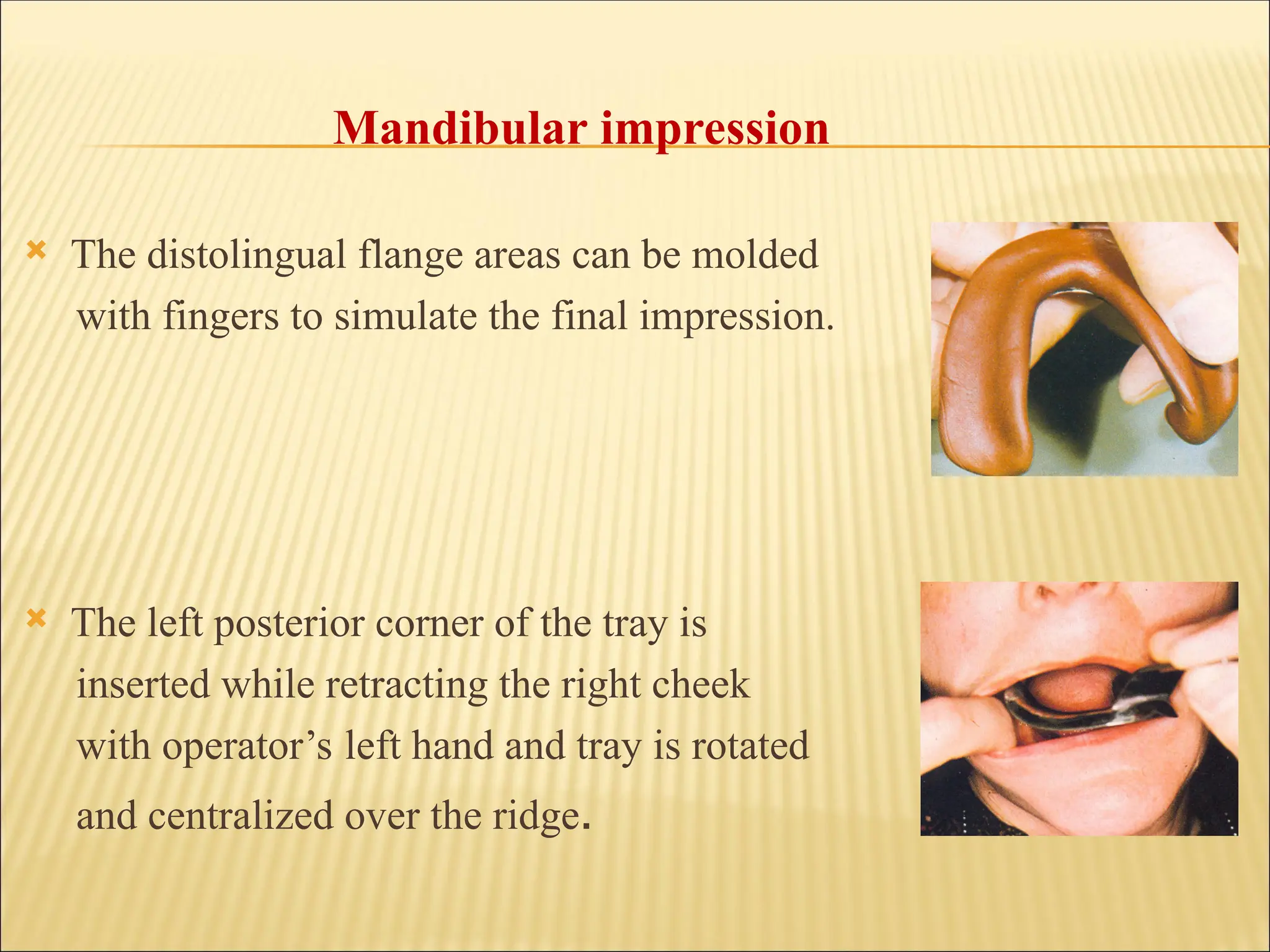 Impression techniques in complete dentures.ppt