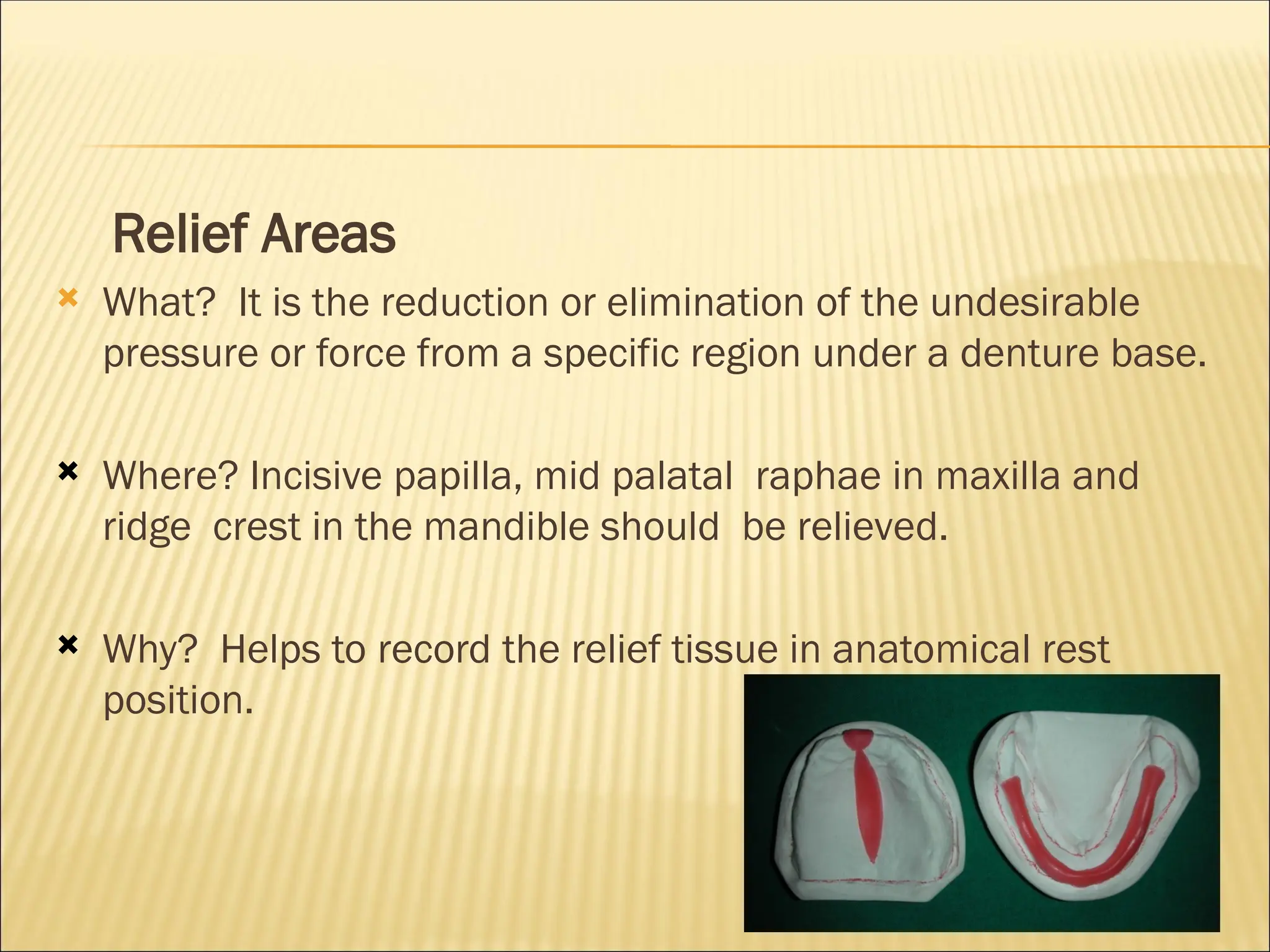 Impression techniques in complete dentures.ppt