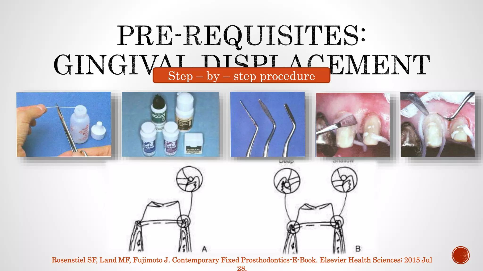 Impression techniques in fpd | PPTX