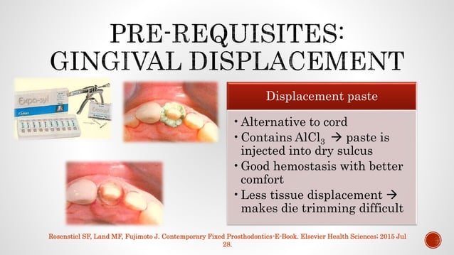 Impression techniques in fpd | PPTX | Dental Health | Diseases and ...