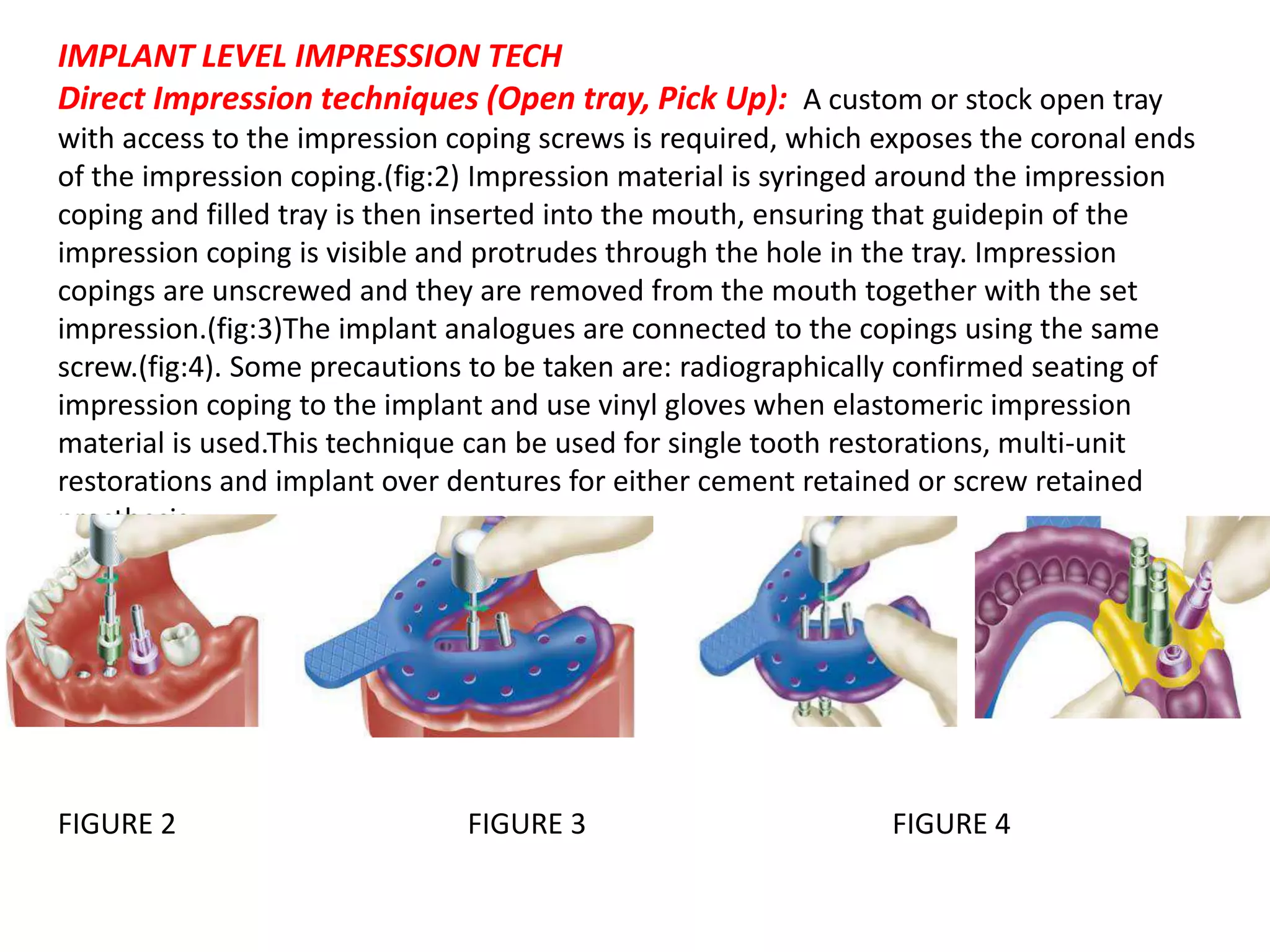 Impression techniques in implants | PPTX