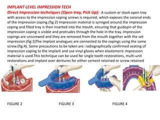Impression techniques in implants | PPTX
