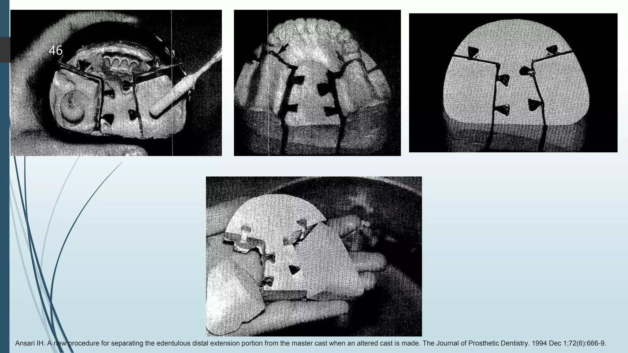 Impression techniques in Removable partial denture.pptx