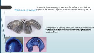 Impression techniques in Removable partial denture.pptx
