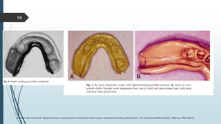 Impression techniques in Removable partial denture.pptx