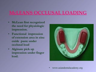Impression techniques in removable partial dentures | PPT