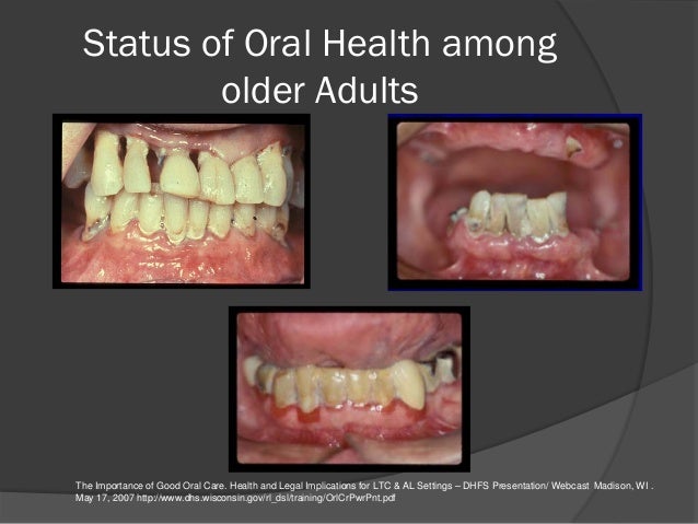 Improved oral health of older individuals in saskatchewan