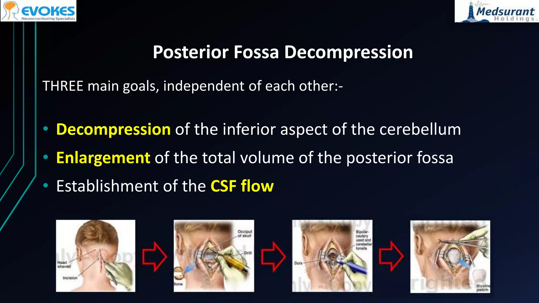 Improved transcranial motor evoked potentials after craniovertebral ...