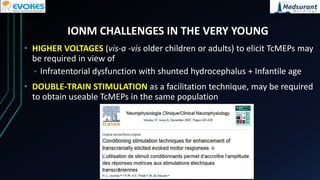 Improved transcranial motor evoked potentials after craniovertebral ...