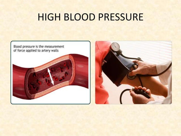 Improve health by having a walk persuasive for public speaking visual ...
