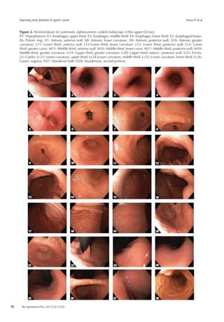 Improving early detection of gastric cancer a novel systematic ...