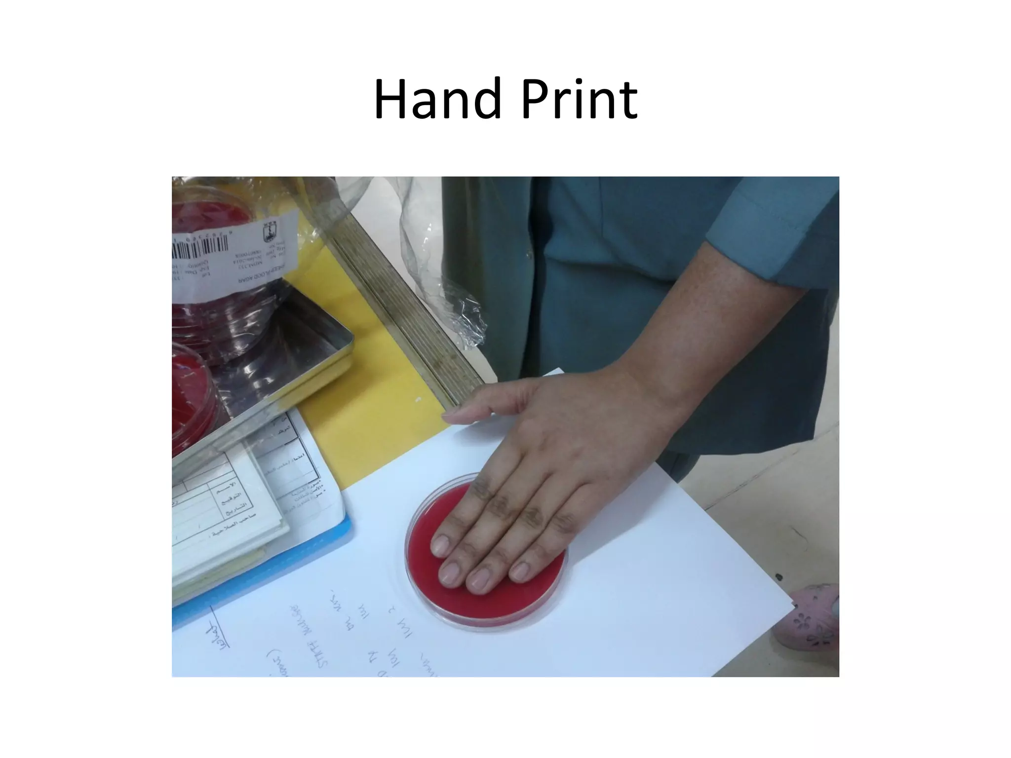 Improving Hand Hygiene Project | PPT