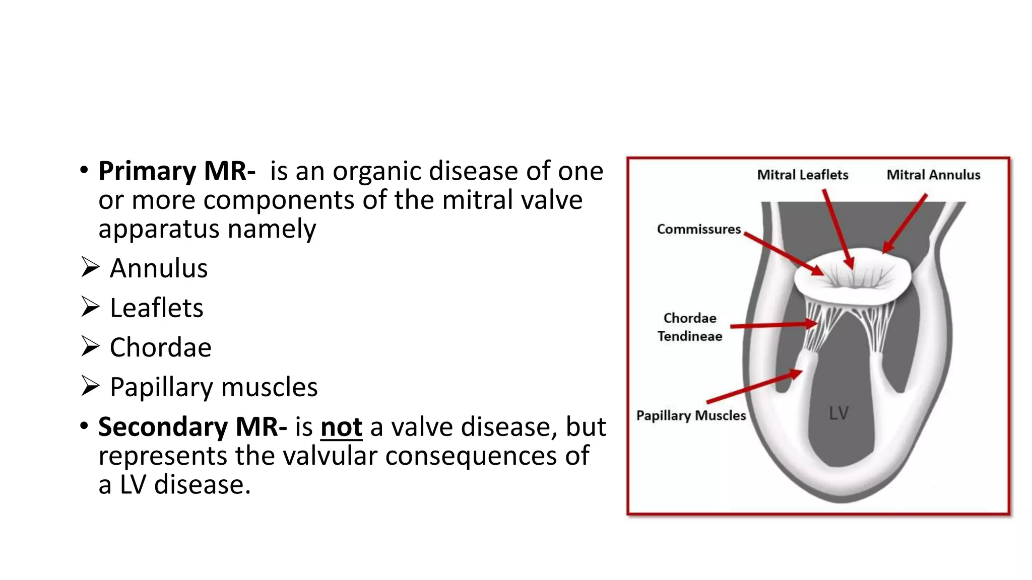 ishemic mitral regurgitation gopan Amrita hospital | PPTX