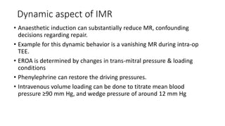 ishemic mitral regurgitation gopan Amrita hospital | PPTX