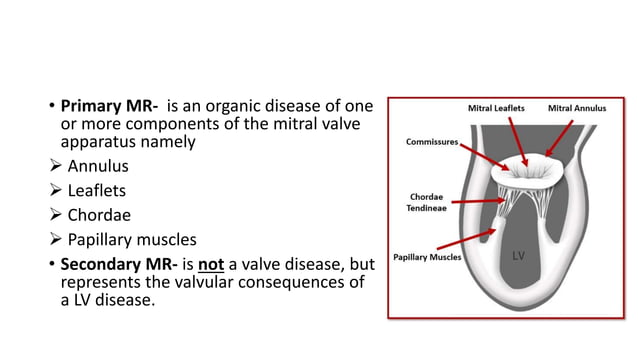 ishemic mitral regurgitation gopan Amrita hospital | PPTX | Heart and ...