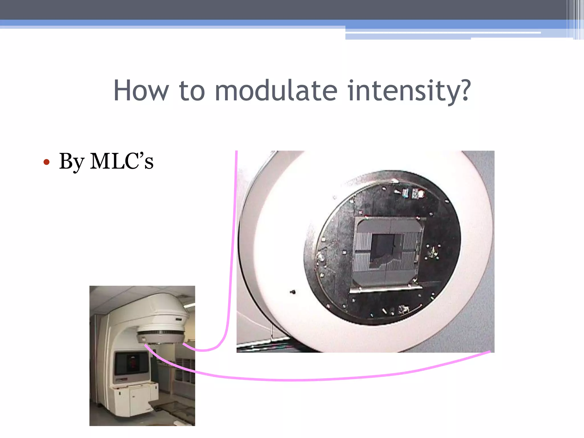 IMRT: Intensity Modulated Radiotherapy | PPTX